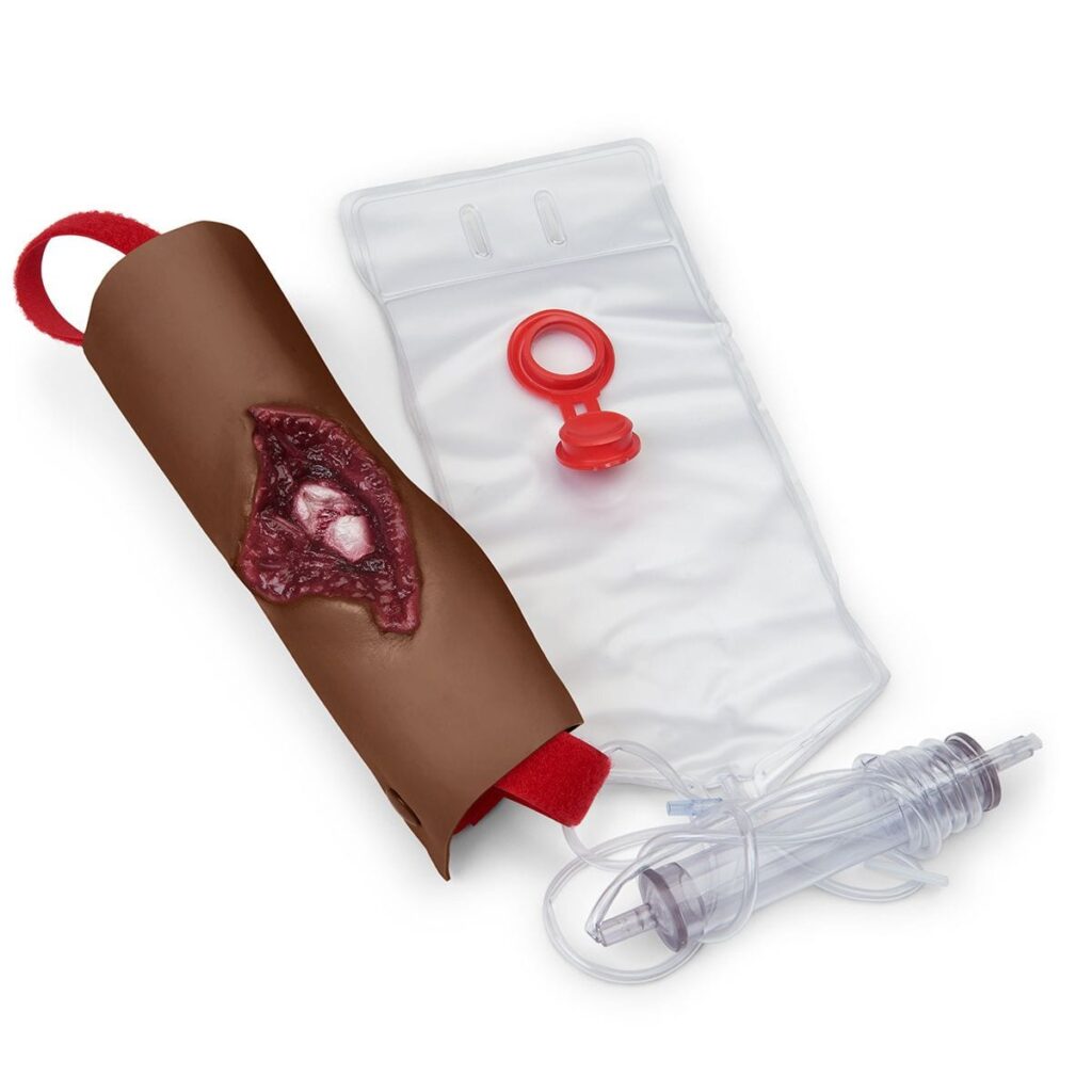 Simulaids® Simulated Compound Fracture - Humerus - Dark - Simulaids